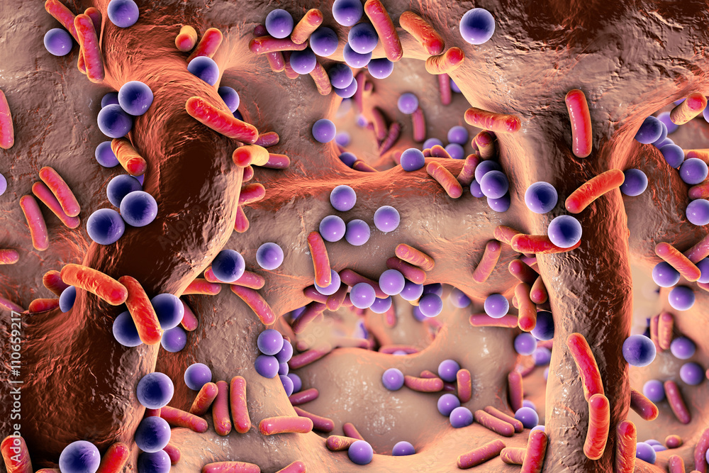 Spherical bacteria inside bone tissue, model of staphylococcus and ...