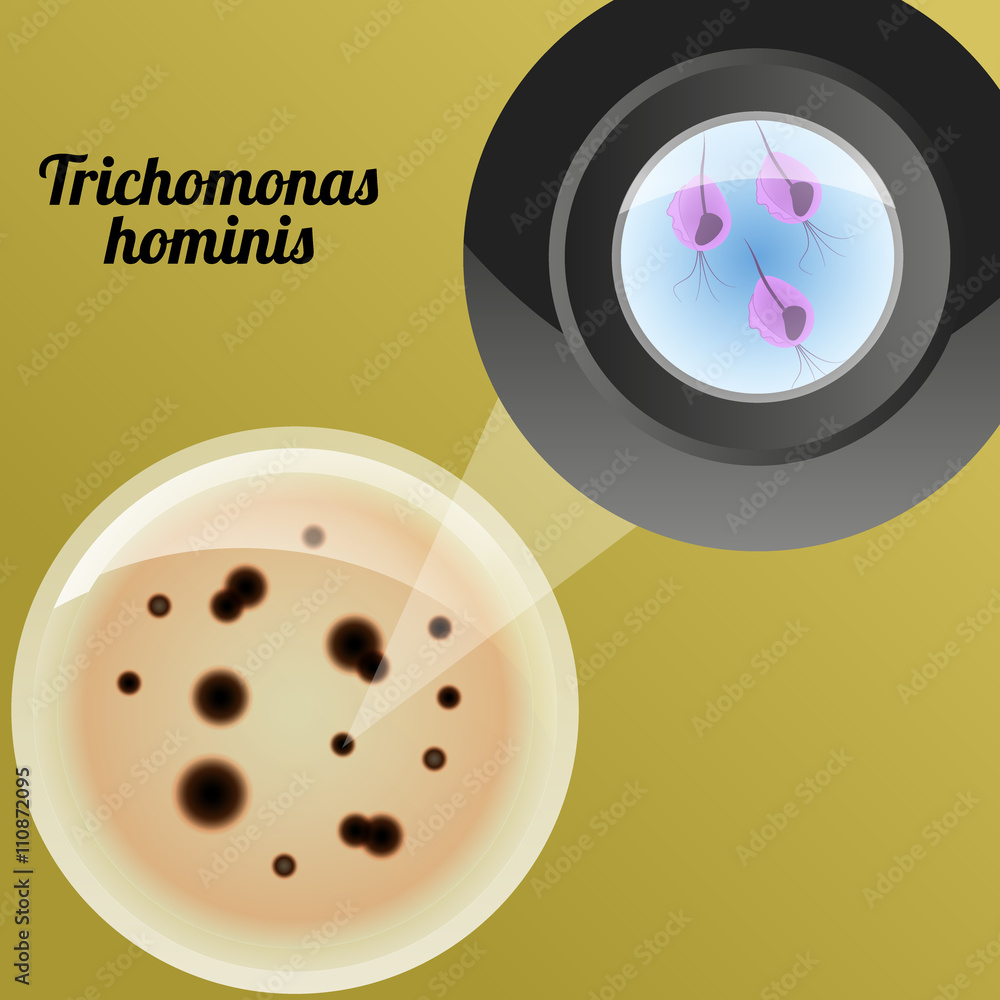 Trichomonas hominis Stock Vector | Adobe Stock
