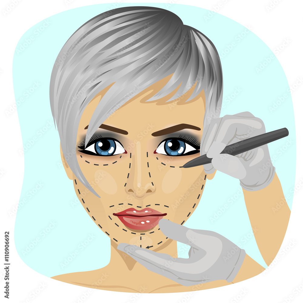 Guide lines for surgical incisions on a patient female face Stock ...