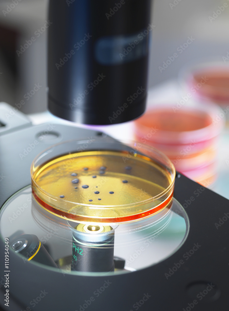 Petri dish containing bacterial culture being examined with inverted ...