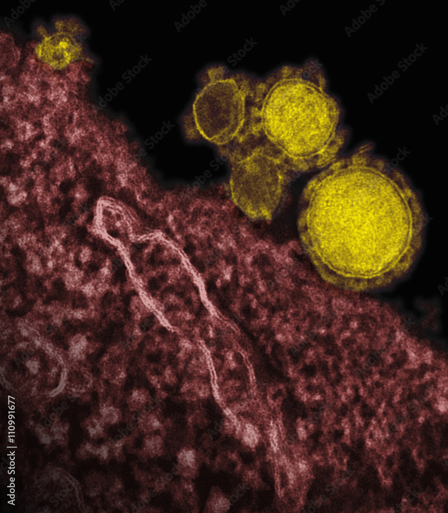 Foto de Colorized transmission electron micrograph (TEM) showing five ...