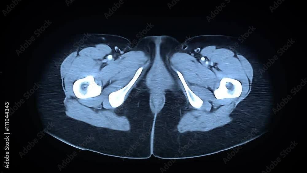 Spine and internal organs MRI scan Stock ビデオ | Adobe Stock