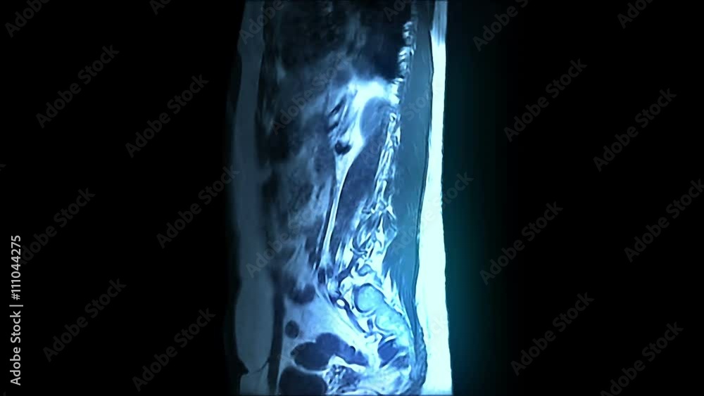 Spine and internal organs MRI scan 素材庫影片 | Adobe Stock