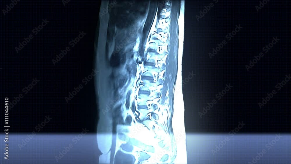 Spine and internal organs MRI scan Stock ビデオ | Adobe Stock