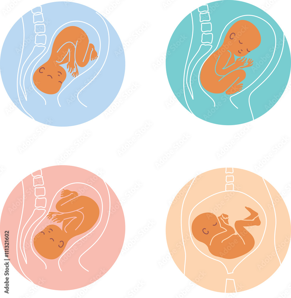 Baby in womb positions. Vector illustration. Baby poses in womb ...