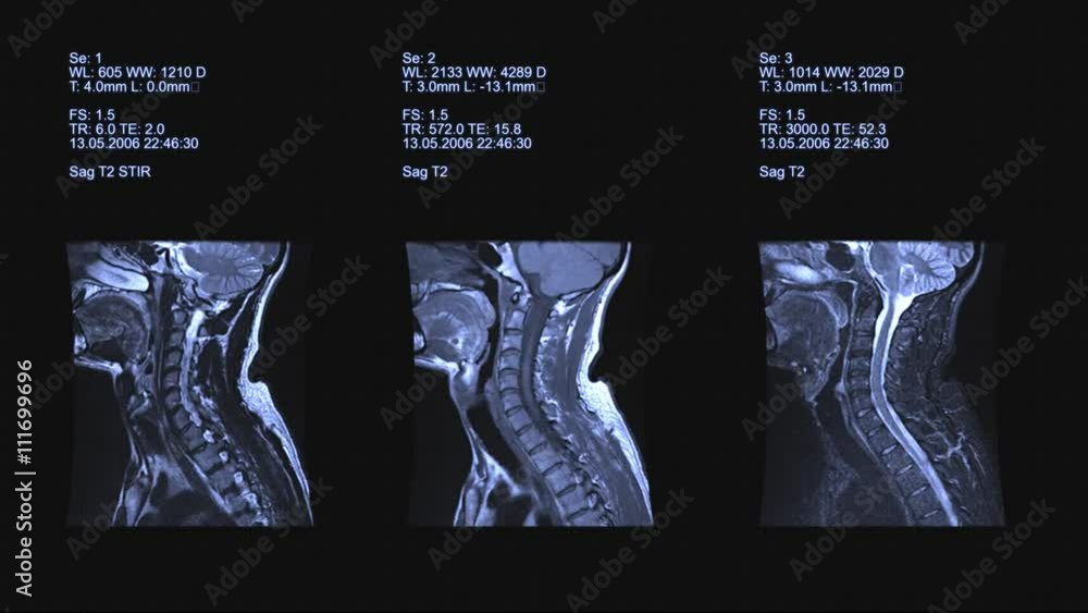 4k set of three neck views of MRI scan. Loopable. Blue, Medical exam ...