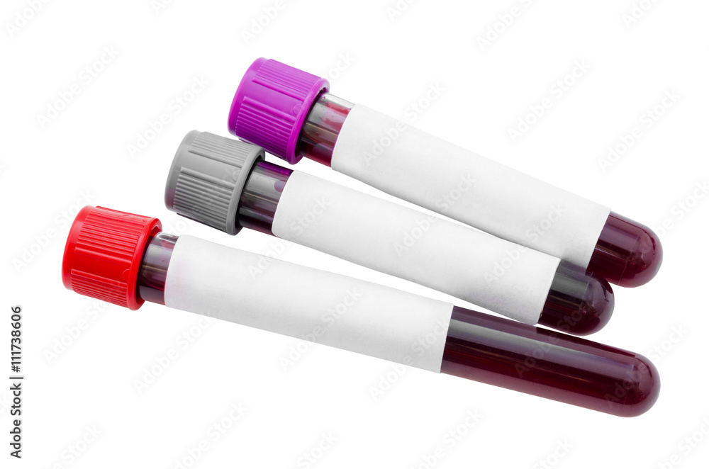 Sample blood in test tubes in laboratory isolated. Stock Photo | Adobe ...