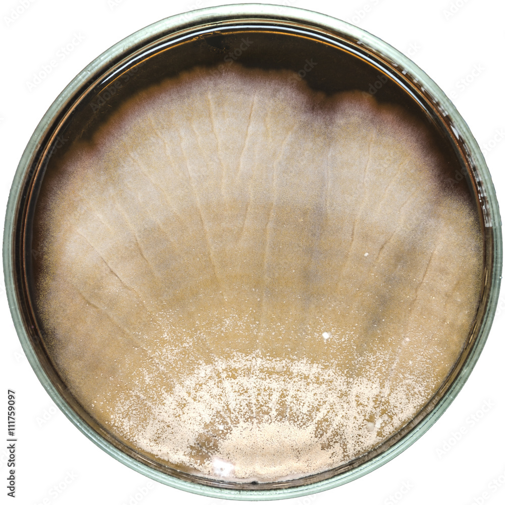 Brown mold contamination on agar plate (petri dish) Stock Photo | Adobe ...