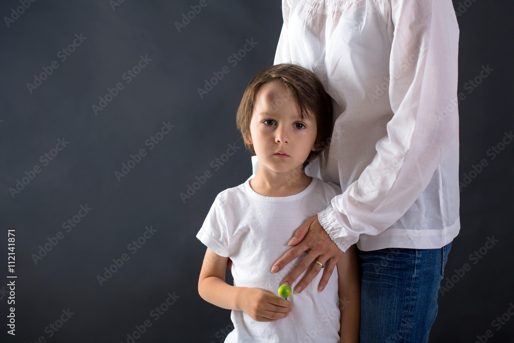Cute little boy with big bump on his forehead from falling, hugg Stock ...
