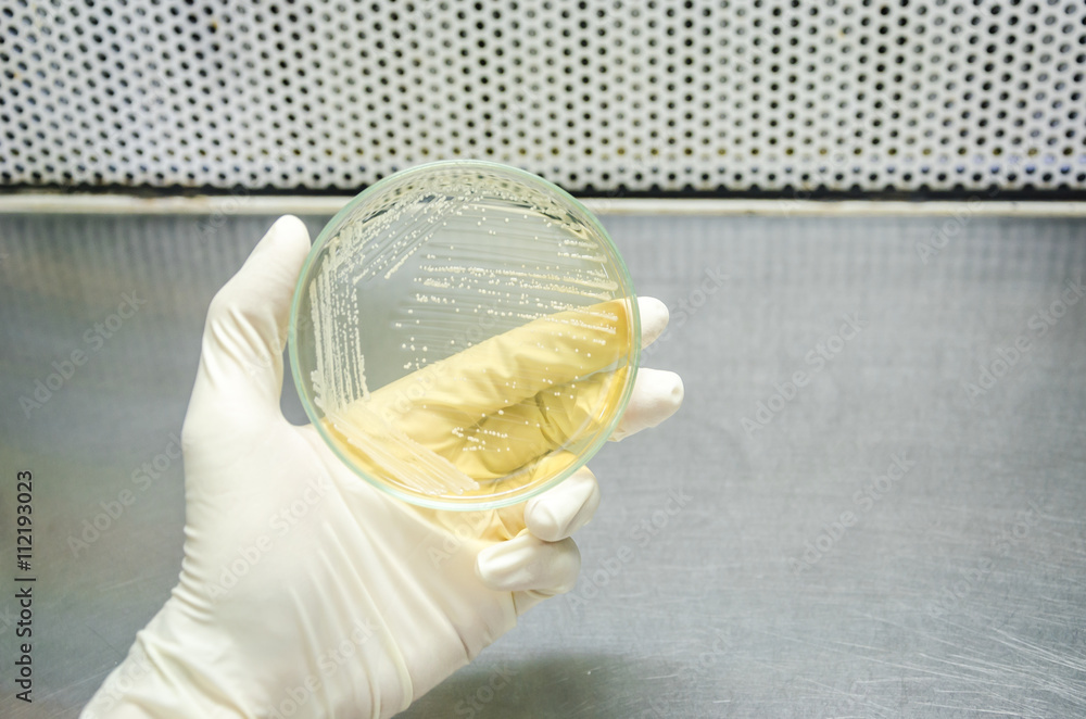 Hand in glove is holding a petri dish of cross streak of Saccharomyces ...