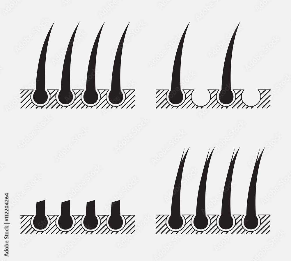 hair vector vector graphic , logo and icon , black hair set Stock ...