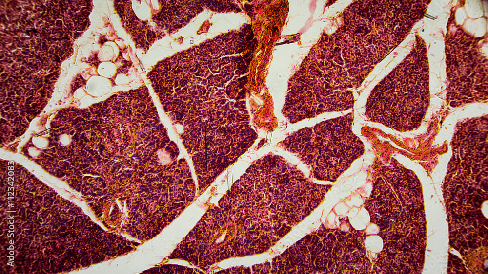menschliche Zellen unter dem Mikroskop - Anatomie / Histologie ...