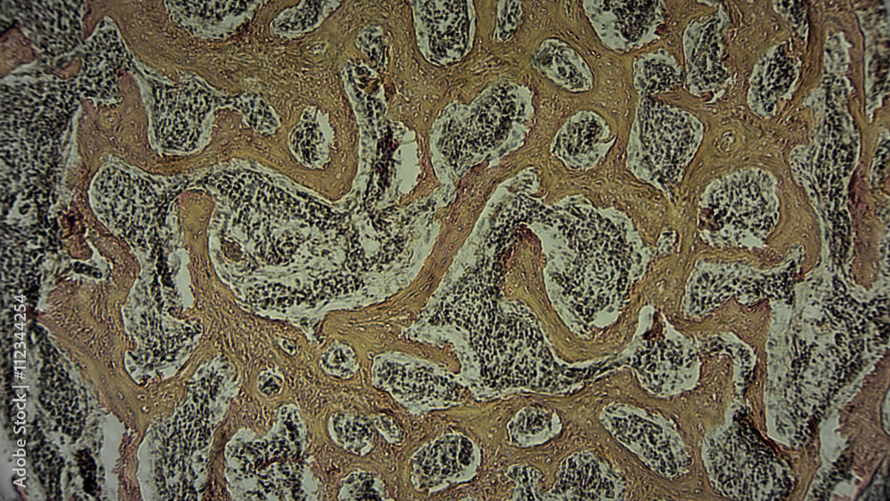 menschliche Zellen unter dem Mikroskop - Anatomie / Histologie ...