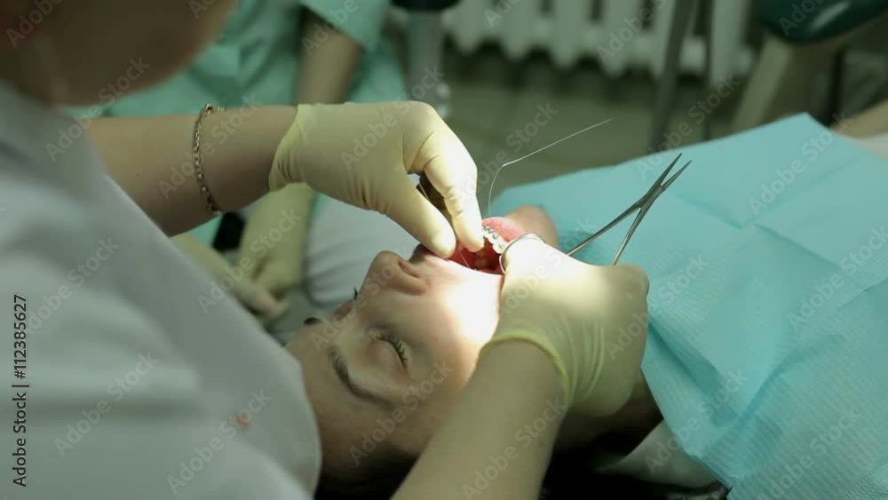 Bite correction. Orthodontist at work. The young woman visiting the ...