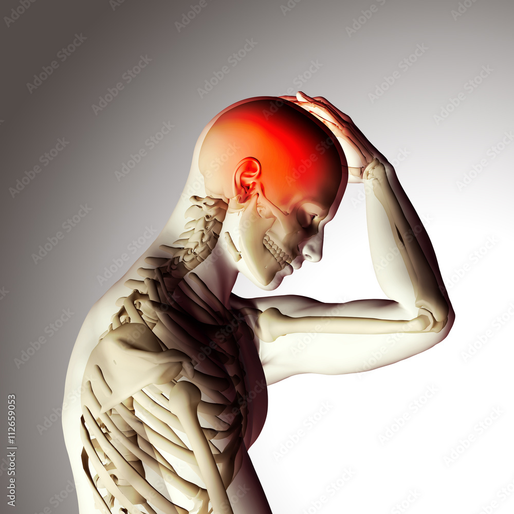3d medical illustration headache Stock Illustration | Adobe Stock