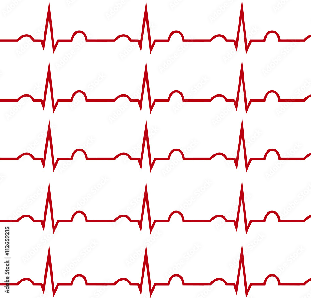 ECG on a white background, isolated Stock Vector | Adobe Stock