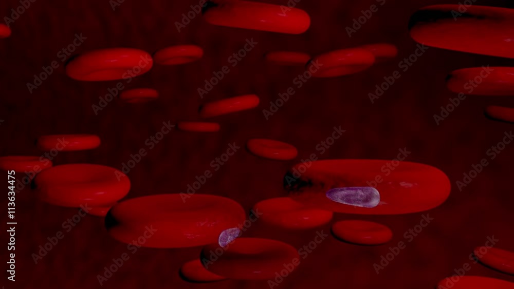 Malaria infection illness. Animation of infection mechanism of malaria ...