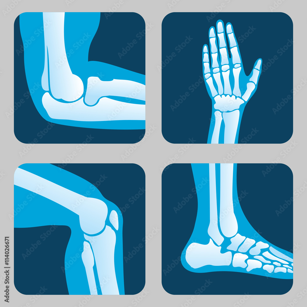 Human joints, knee joint, elbow joint, ankle joint, wrist. Medical ...