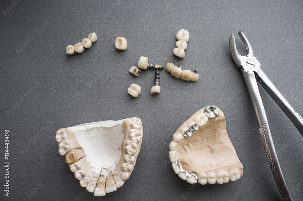 Dental prosthesis equipment flat lay. Top view on two gypsum jaws ...