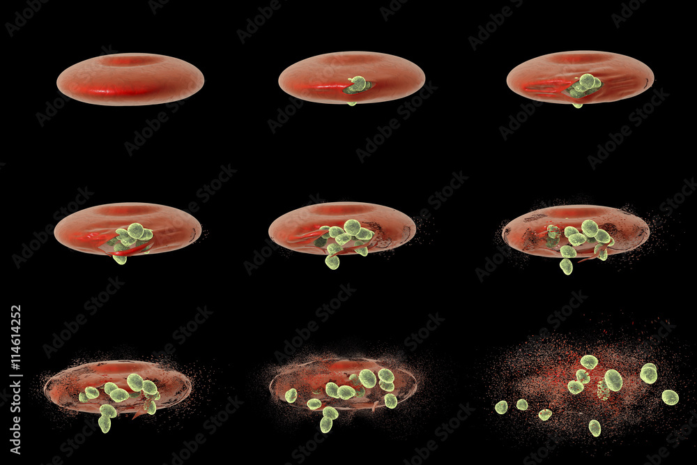 Malaria. Series of images showing release of malaria parasites from red ...