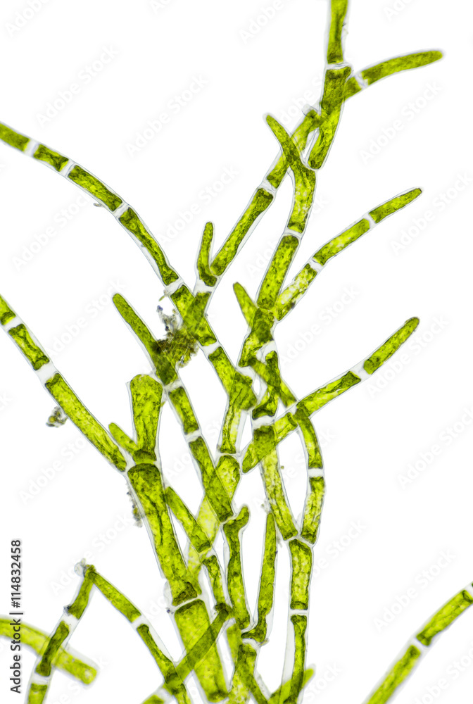 Cladophora Algae Under Microscope