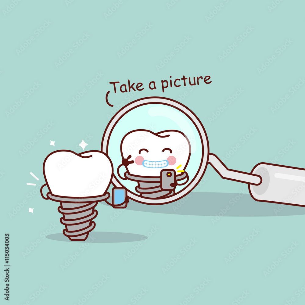 cartoon implant tooth take picture Stock Vector | Adobe Stock