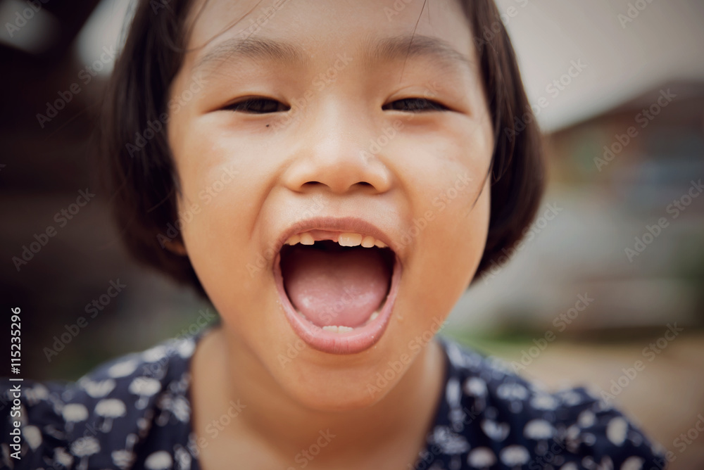 Cute little girl have broken teeth and smiling,asian child Stock Photo ...
