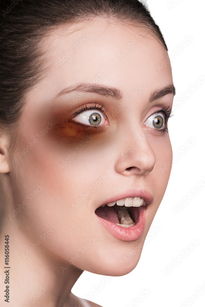 Beaten woman face Stock Photo | Adobe Stock