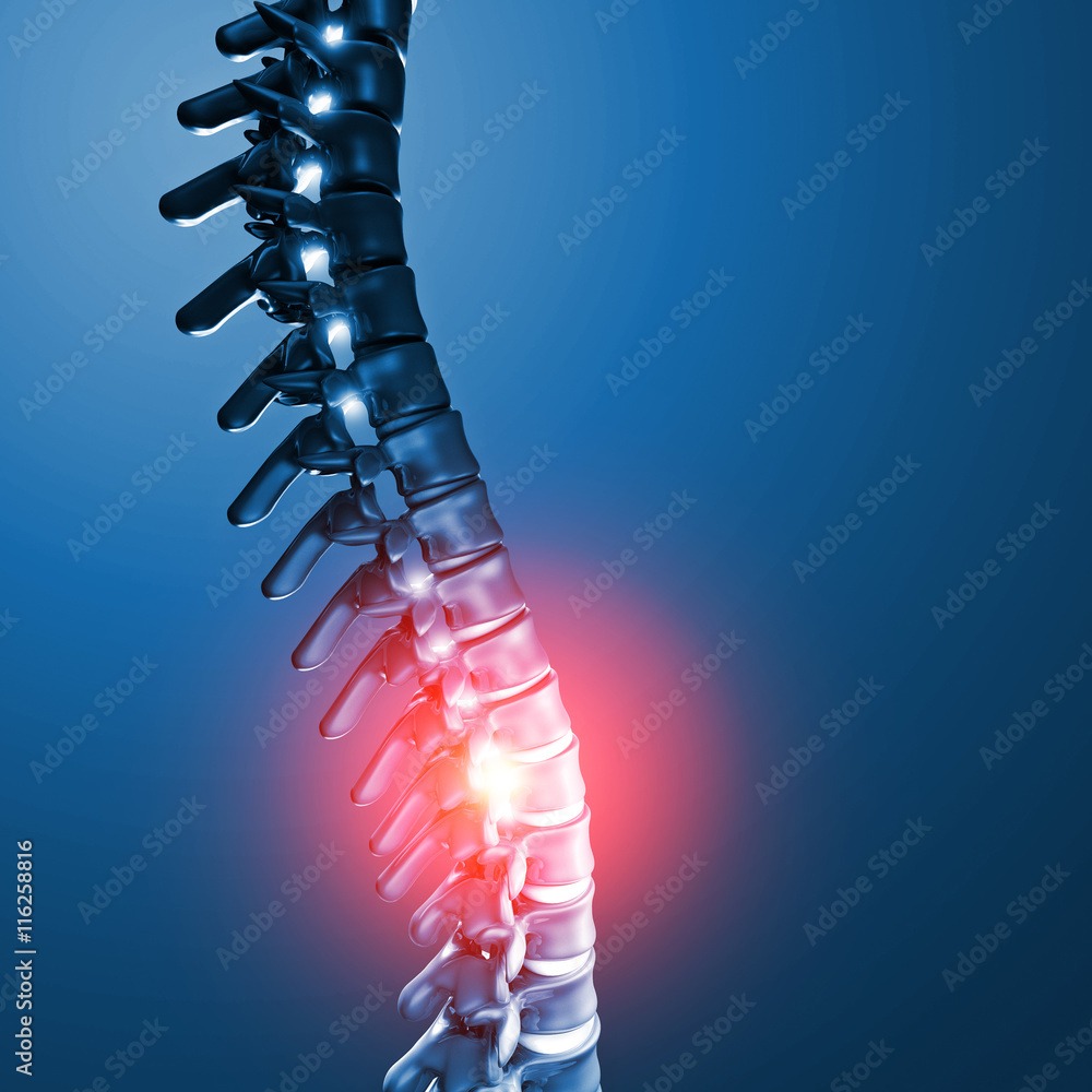 3d image of a blue spine with red areas indicating health problems ...