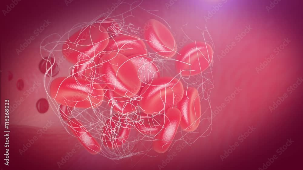 Blood vessel cut, blood cells (erythrocytes, leucocytes, thrombocytes ...