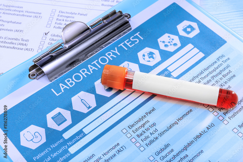 Blood sample on medical report Stock Photo | Adobe Stock