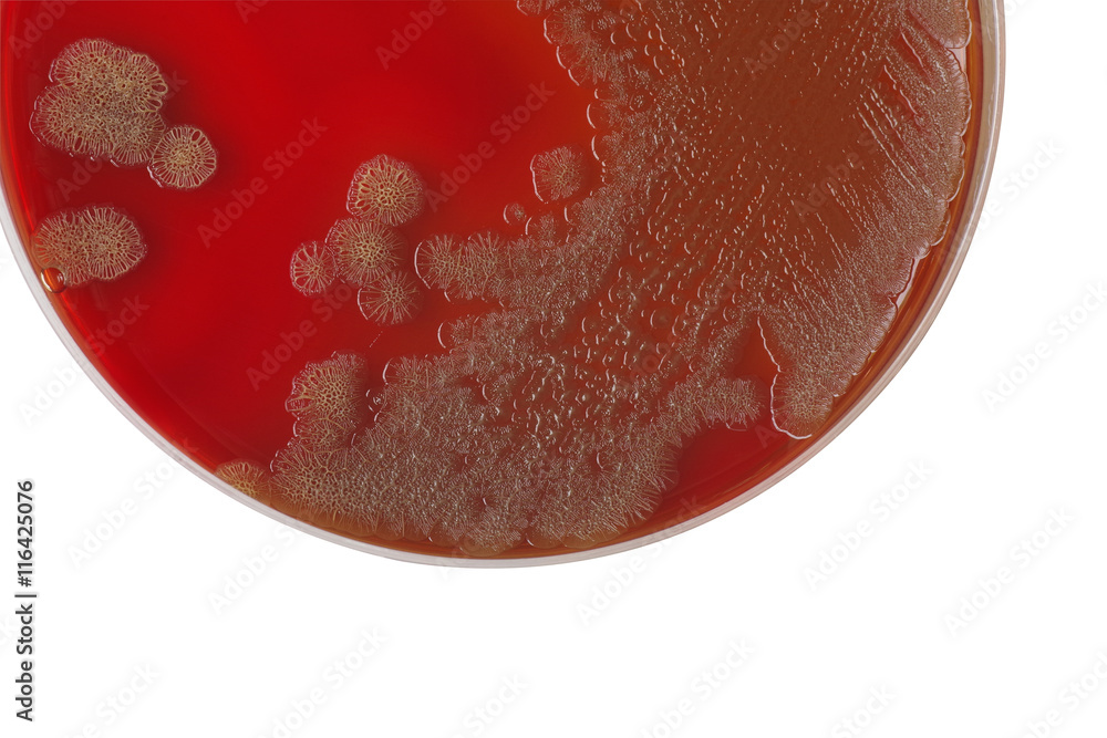 Vibrio cholerae bacterial colonies on blood agar plate, medical Stock ...