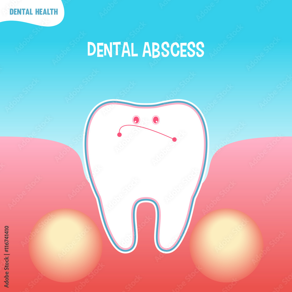 Cartoon bad tooth icon with dental abscess Stock Vector | Adobe Stock
