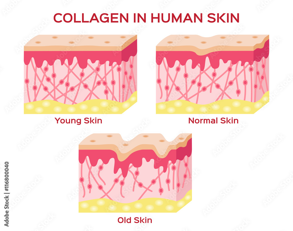 Vetor de collagen in younger skin and aging skin , 3 type collagen skin ...
