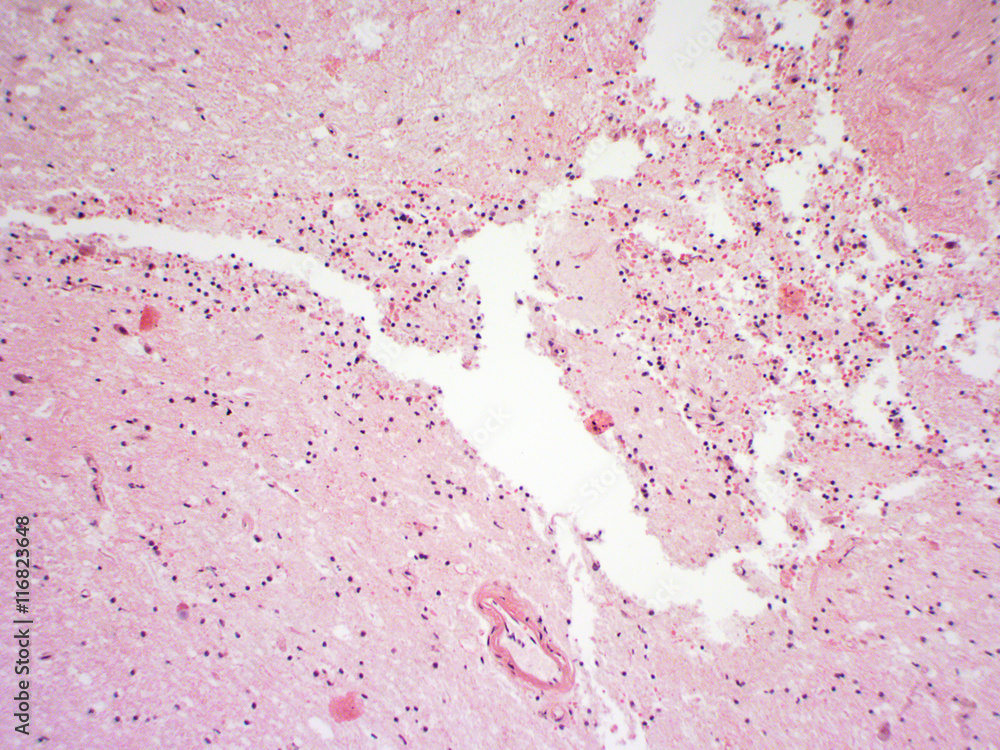 Brain tissue, microscopic view magnification x 100 Stock Photo | Adobe ...