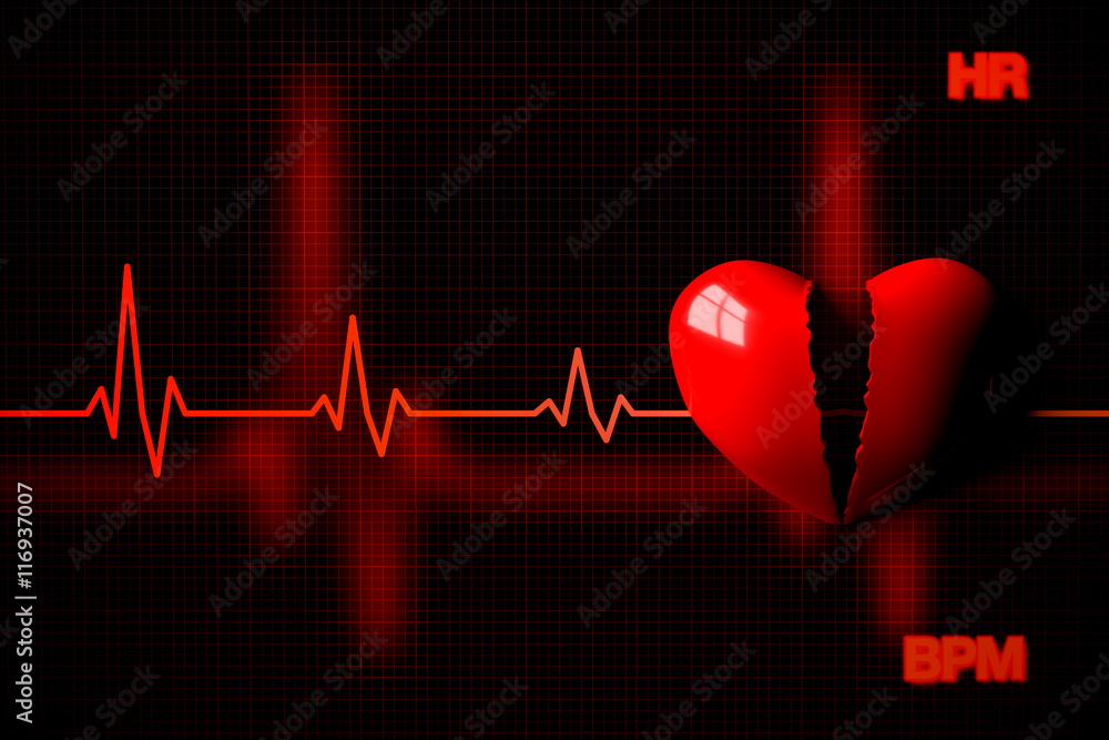 Heart Failure Concept Illustrated by Broken Heart, 3D Rendering Stock ...