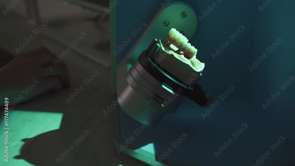 Dental prosthetic restoration. Denturist is making 3D-model for ...