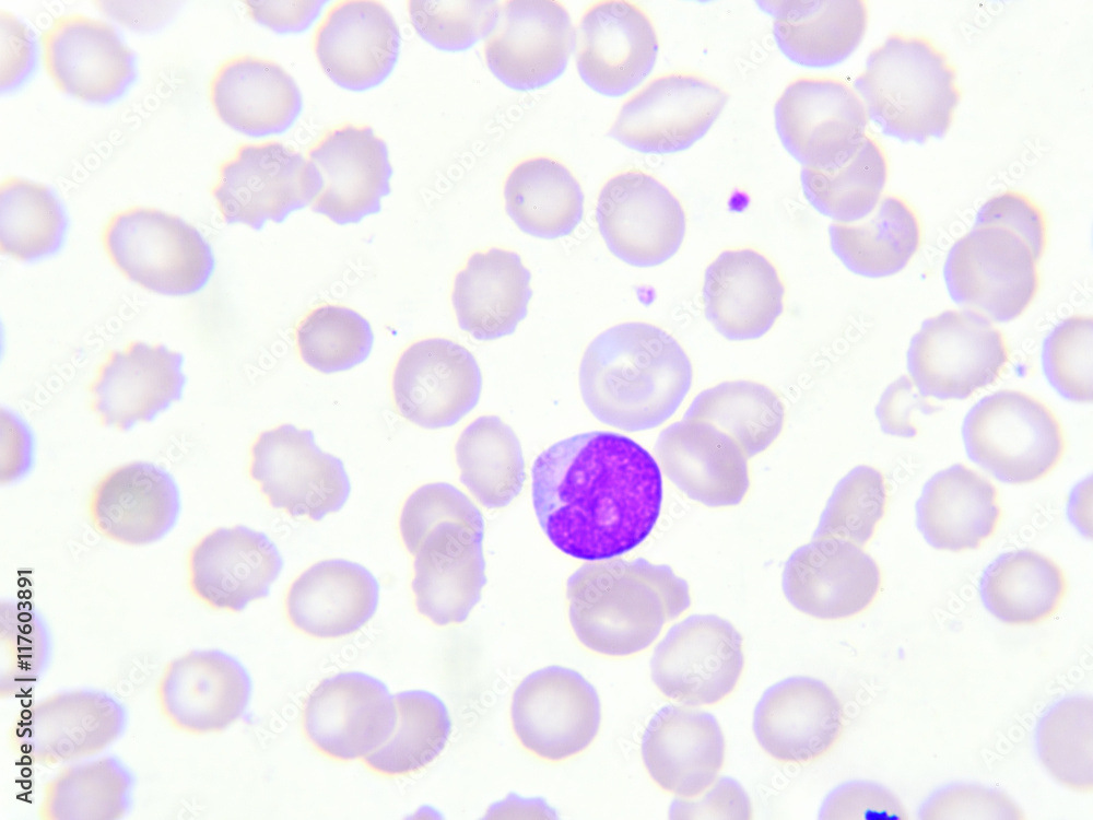 White blood cell in peripheral blood smear, Wright stain Stock Photo ...