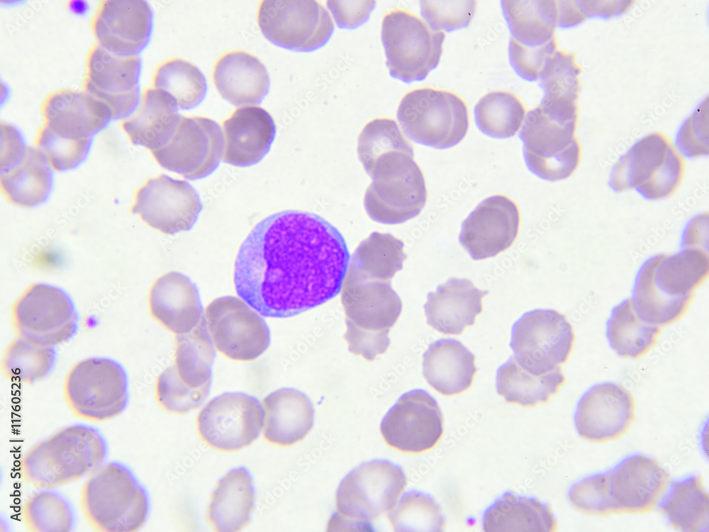 White blood cell in blood smear Stock Photo | Adobe Stock