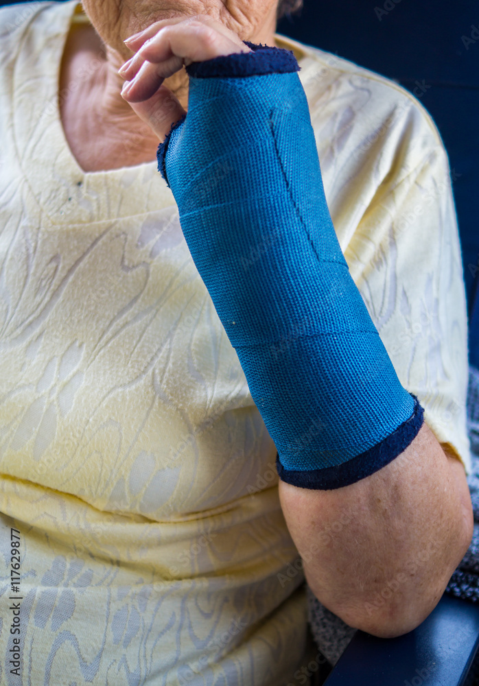 Rentnerin mit Gipsarm Stock-Foto | Adobe Stock