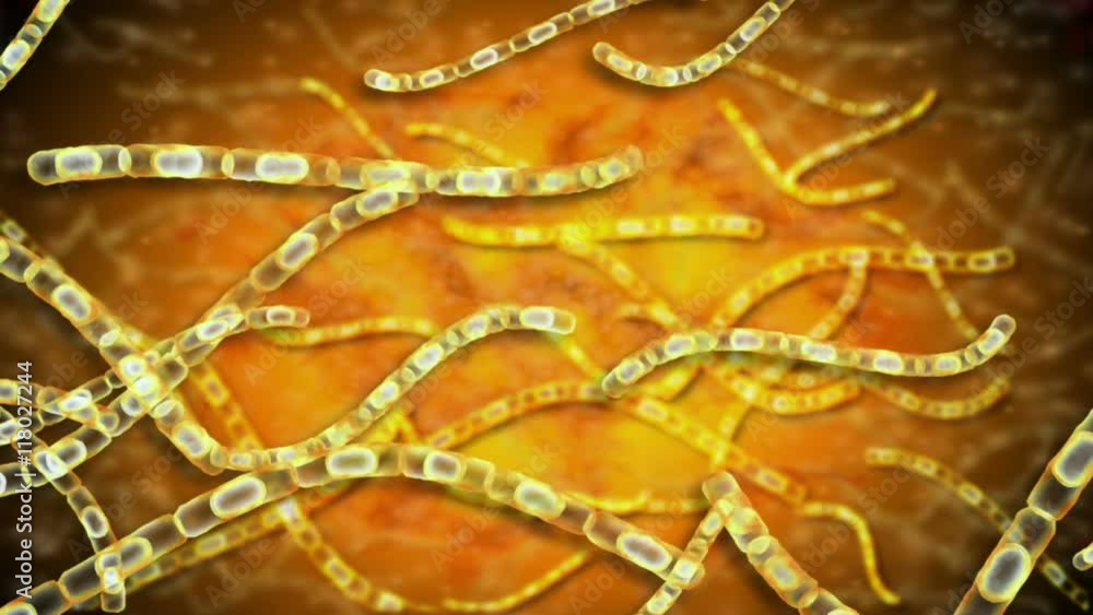 Microscopic visualization of anthrax. Anthrax is an acute disease ...