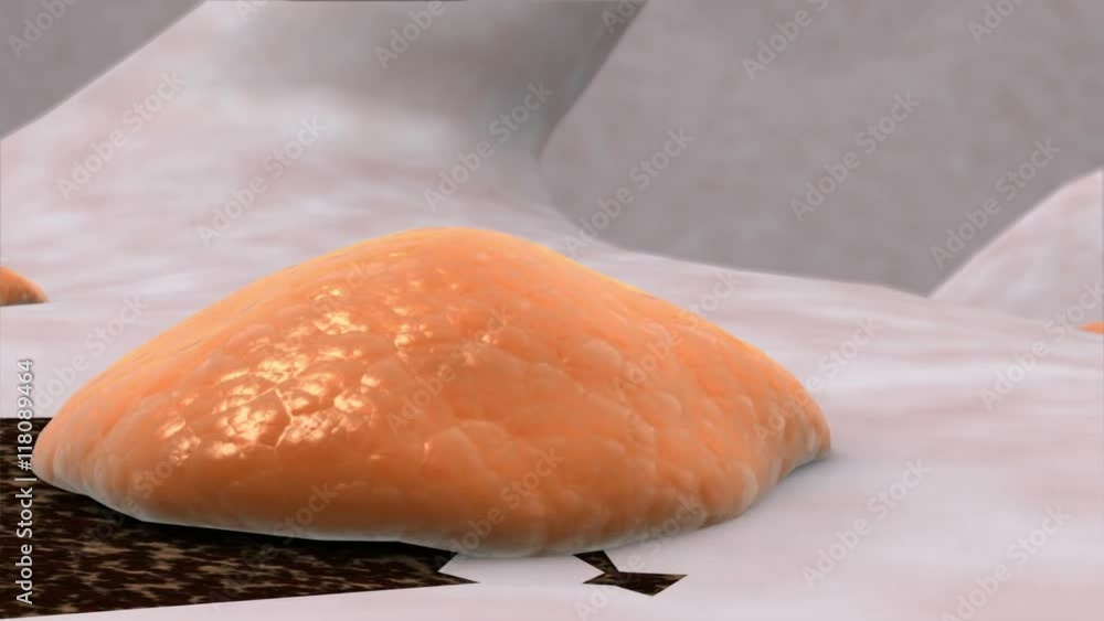 Osteoclast breaking down bone tissue. Stock Video | Adobe Stock