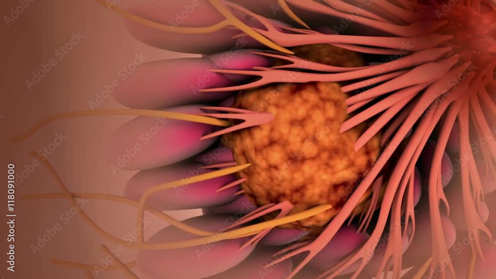 Biomedical visualization of breast cancer/tumor developing and ...