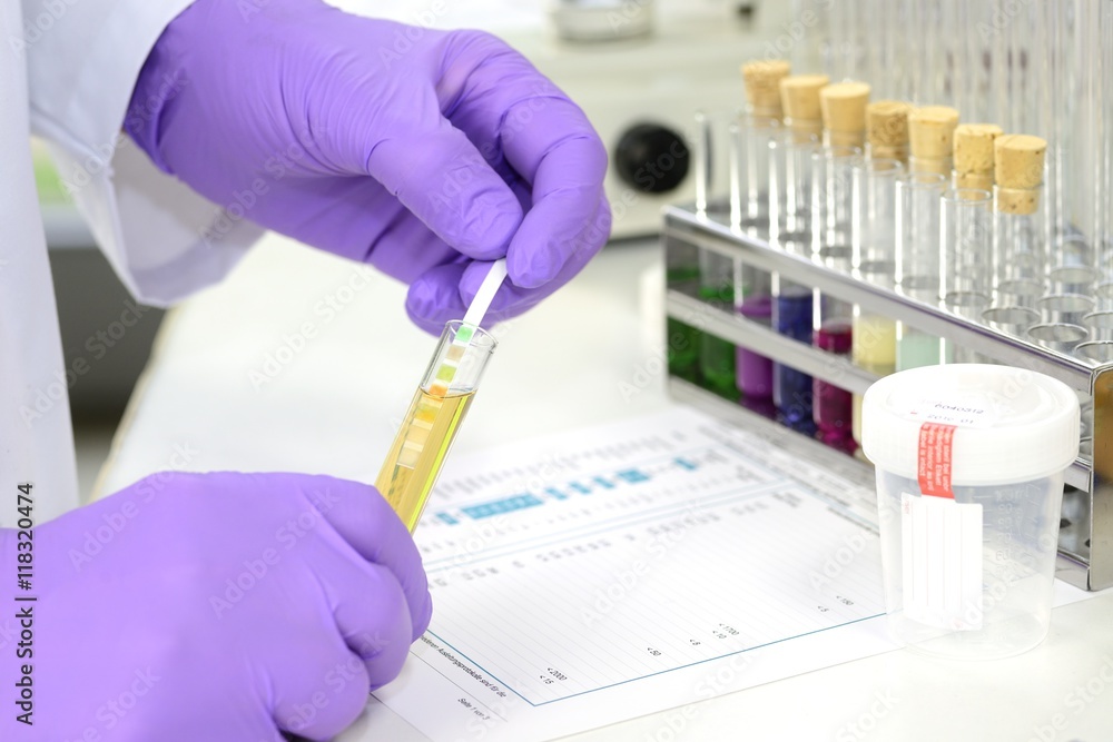 Urinprobe im Labor mit Urinteststreifen Stock Photo | Adobe Stock