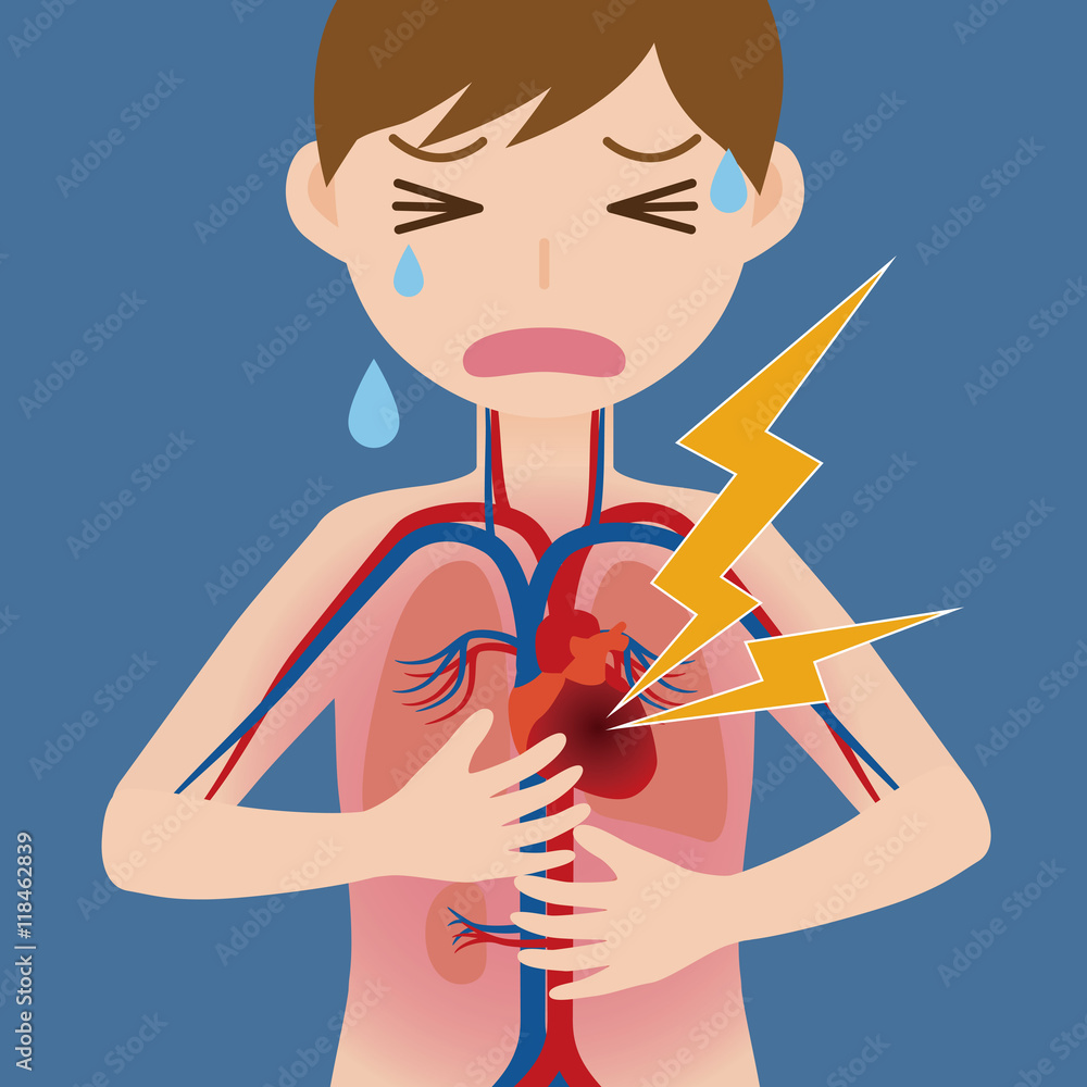 human circulatory system and heart infarction, cardiac infarction ...