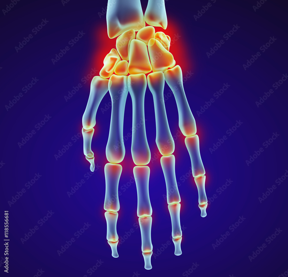 Human wrist anatomy. Xray view. Medically accurate 3D illustration ...