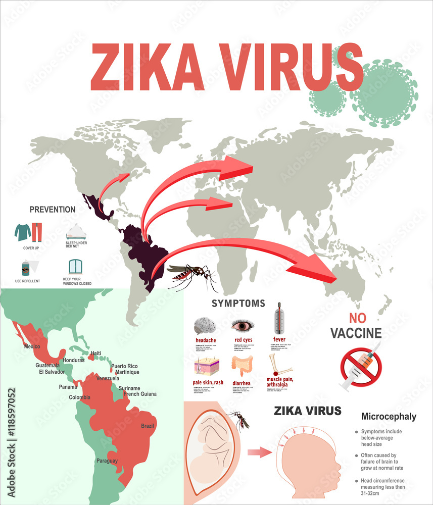 Zika virus infographic elements - prevention, transmission, vaccine, symptoms, microcephaly ...