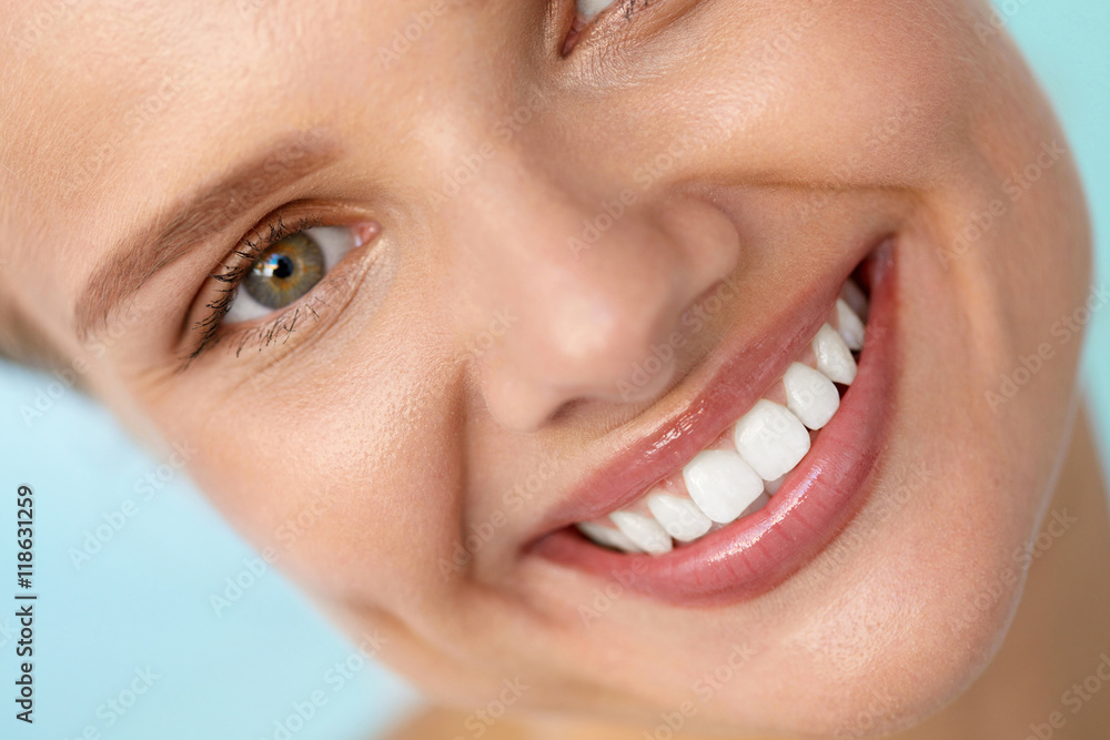 Beautiful Smile. Smiling Woman Face With White Teeth, Full Lips. High ...