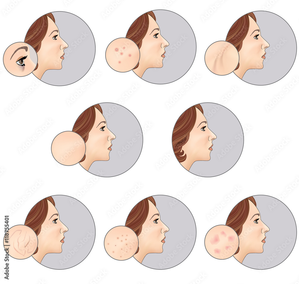 Skincare label vector set. Woman's skin before and after the procedure ...