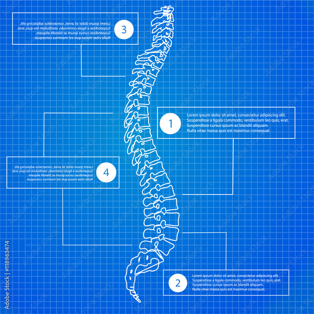 Beautiful timeline infographic medic spine human on the blueprint ...